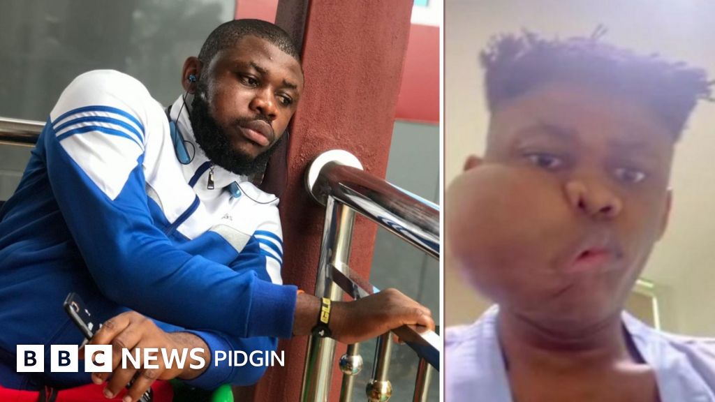 Gland tumour: Madu Chisom on how im bin consider to kpai im sef sake of ...