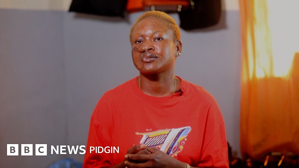 Bassey Peace: 'I wear my scar wit pride becos na who I be' - BBC News ...