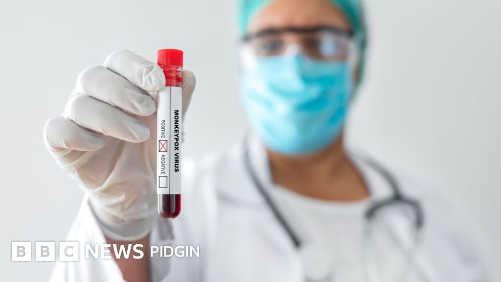 Monkeypox outbreak 2022 deaths: Brazil and Spain record first death ...