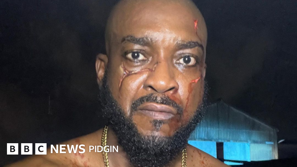 'Shanty Town na ansa to my Bell's Palsy palava' - Chidi Mokeme - BBC ...