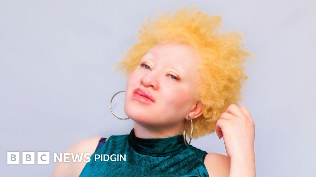 Albinism awareness: ‘My rapist believe say attacking pesin wit albinism go protect am from ...
