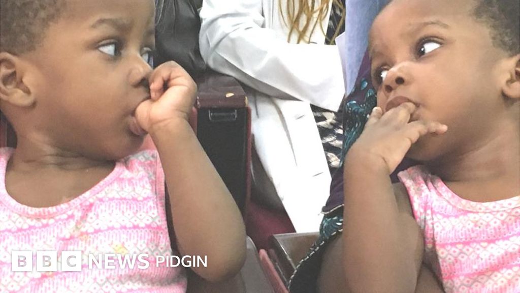 Conjoined Twins: I tink say I comit abomination to born conjoin twins ...