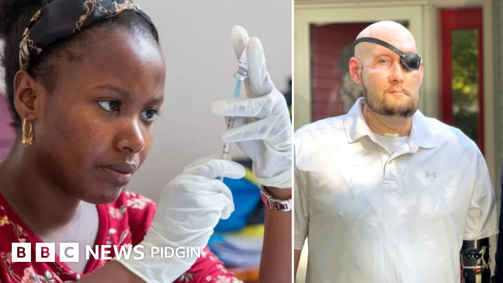 Medical breakthroughs 2023: First eye transplant and second malaria ...