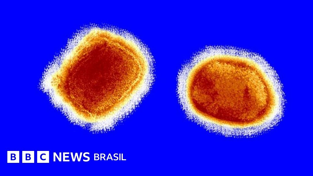 O que é a varíola dos macacos e quais os sintomas da doença: resumo ...