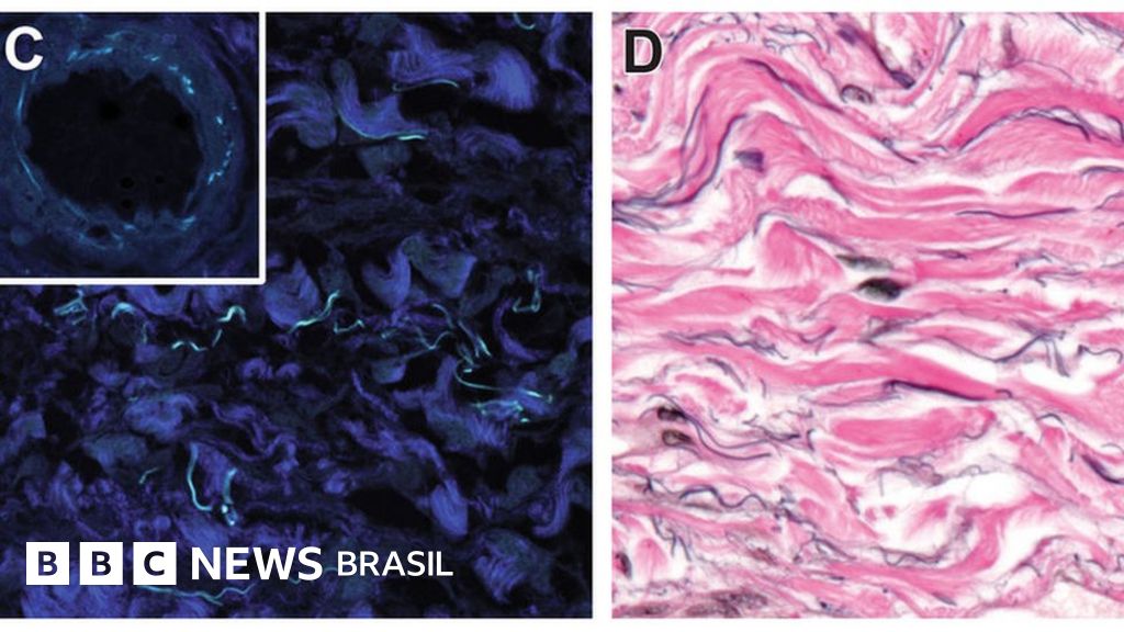 Interstício, o 'novo órgão' do corpo humano que a ciência acaba de ...