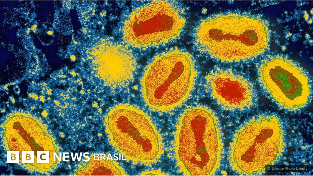 Os vírus mortais que desapareceram sem deixar vestígios - BBC News Brasil