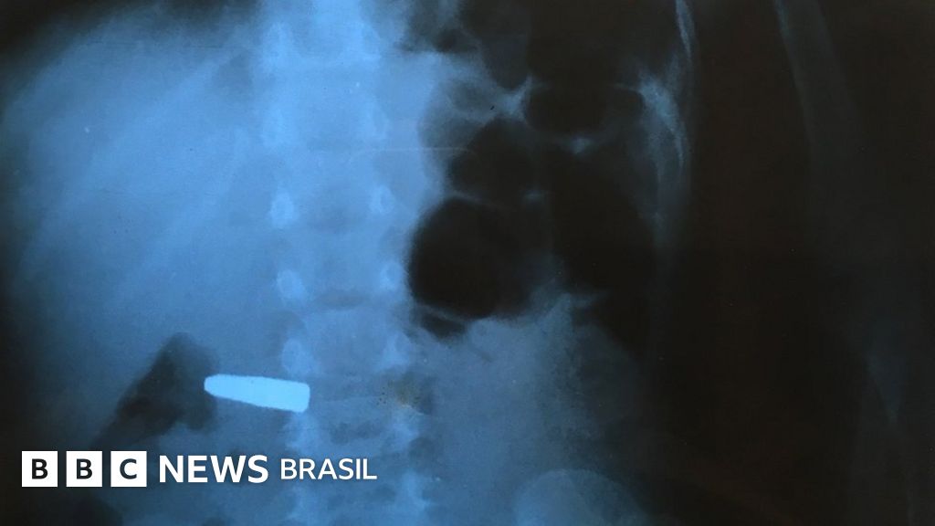 Por Que Tiros De Arma De Fogo Acabam Confundidos Com Outros Tipos De