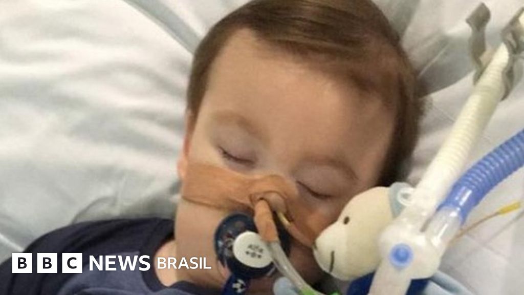 Bebê Centro De Polêmica Que Envolveu Até O Papa Morre 5 Dias Após Ter