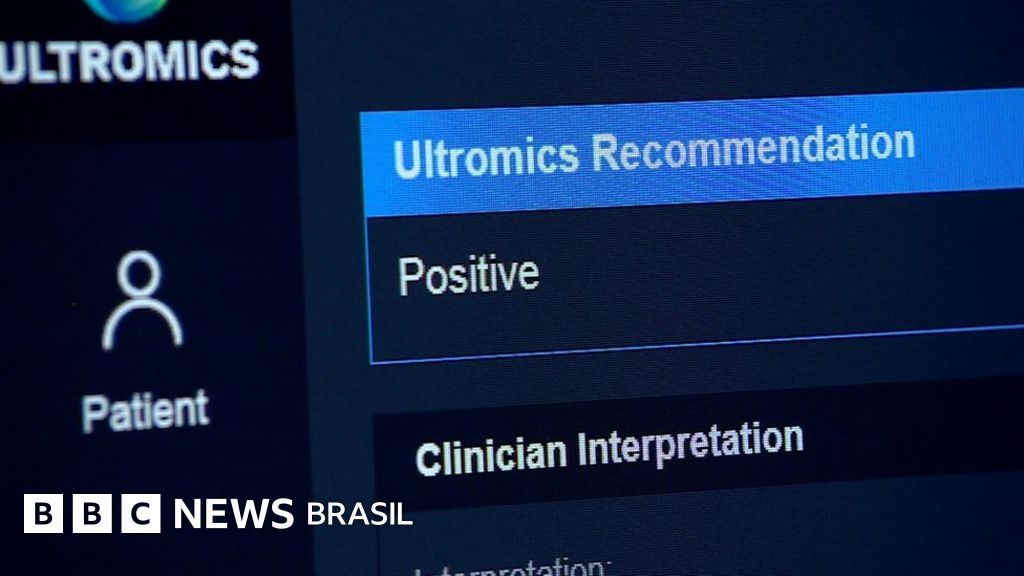 Inteligência artificial pode levar ao diagnóstico precoce de doenças ...