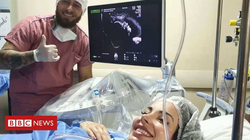 Em Cirurgia Inédita No Brasil Médica Queima Tumor De Bebê Ainda No