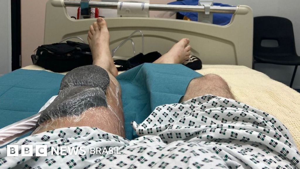 'Quase morri por causa de um arranhão': britânico conta como escapou de ...