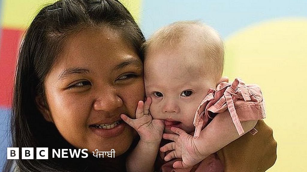 ਸਰੋਗੇਸੀ: ਉਧਾਰ ਦੀ ਕੁੱਖ, ਤੋਹਫ਼ਾ ਹੀ ਨਹੀਂ, ‘ਸ਼ੋਸ਼ਣ ਦਾ ਨਵਾਂ ਤਰੀਕਾ’ ਵੀ - BBC ...