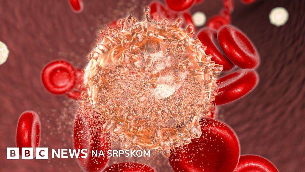 Svetski dan borbe protiv raka: Karcinom godišnje odnese 20.000 života u Srbiji - BBC News na srpskom