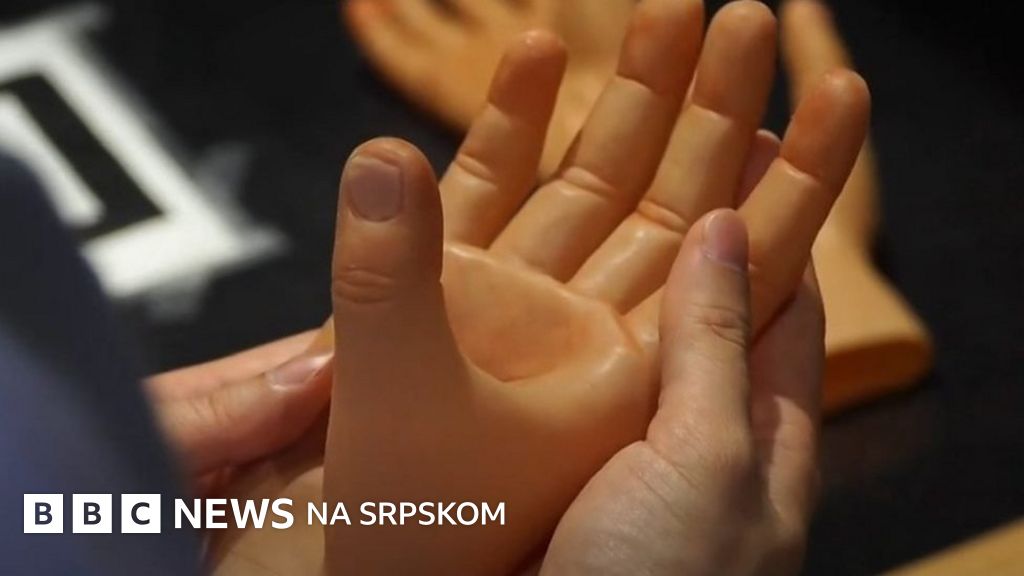 Roboti pomažu ljudima bez ruke da ponovo osete dodir - BBC News na srpskom