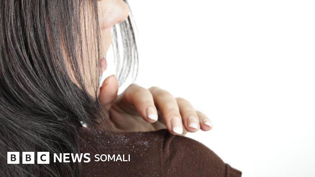Agoolka ama Toxobta wax dawo ah miyuu leeyahay? - BBC News Somali