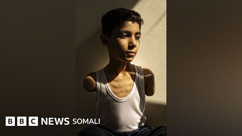 Sawir laga qaaday wiil ku dhaawacmay Qasa oo loo aqoonsaday sawirka ...