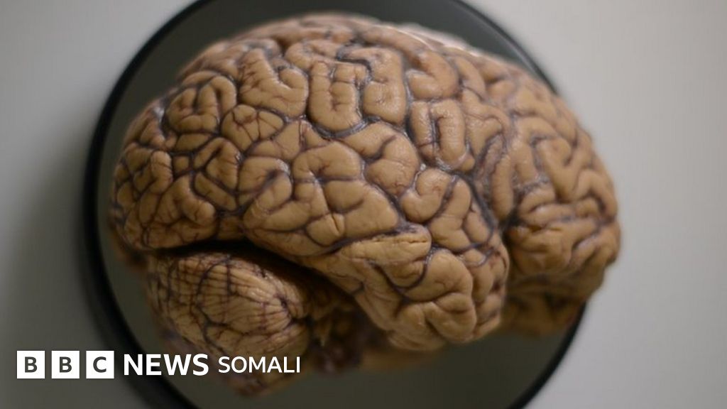 Ma ku deeqi lahayd Maskaxdaada? - BBC News Somali