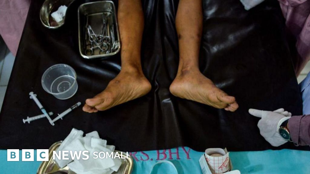 Sida wiil 10 jir ah ugu dhintay gudniin lagu sameeyay iyo halista ...