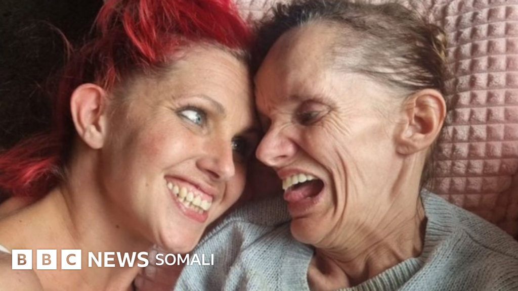 Xanuunka aan dunida laga aqoon ee ay la daalaa dhacayaan hablahan iyo ...