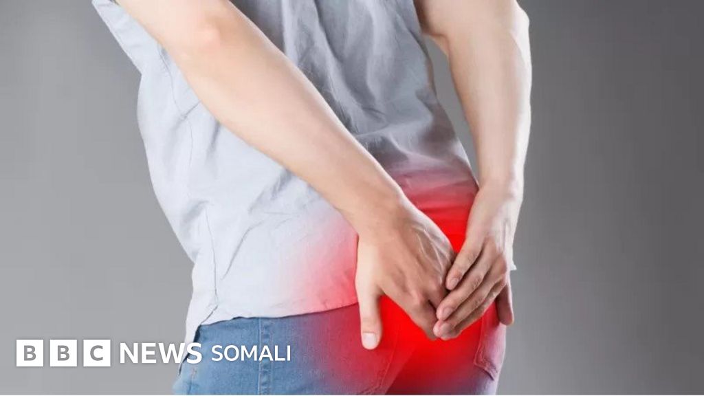Cudurka Baabasiirka wuxuu ka dhashaa hab nololeedka iyo cunnooyinka uu qofku qaato - BBC News Somali