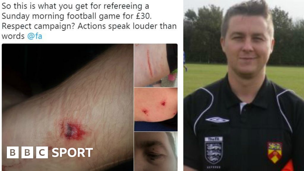 Sunday morning football referee quits after alleged assault by player ...