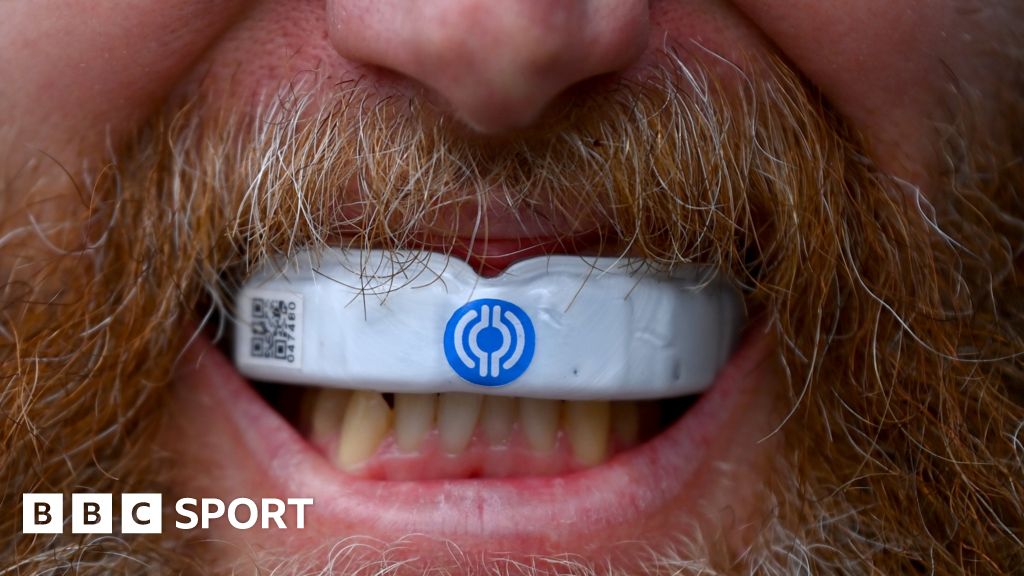 Smart gumshields: Why were they introduced, and what more can be done ...