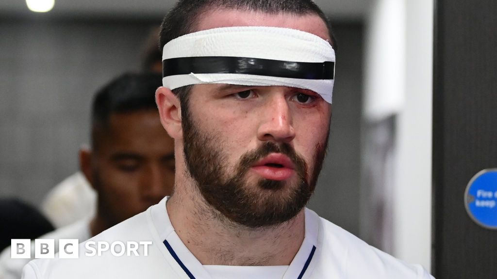 England v South Africa; Springboks may underestimate us says Richard ...