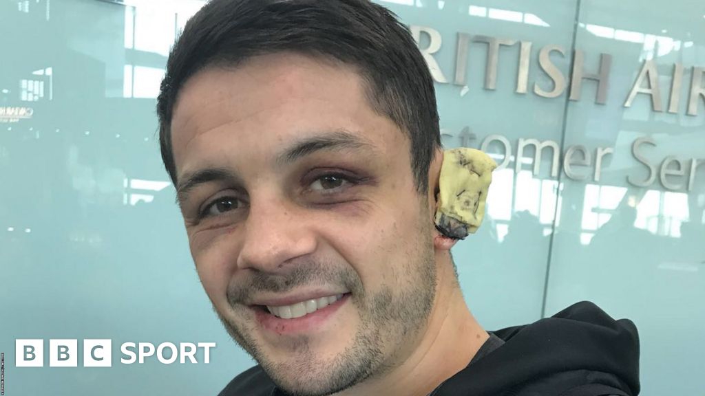 Stephen Smith: Ear injury in loss to Francisco Vargas was 'worst pain ...