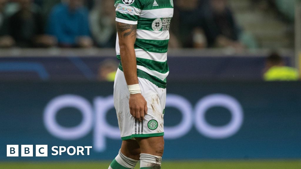 Celtic face injury sweat over international quartet - BBC Sport