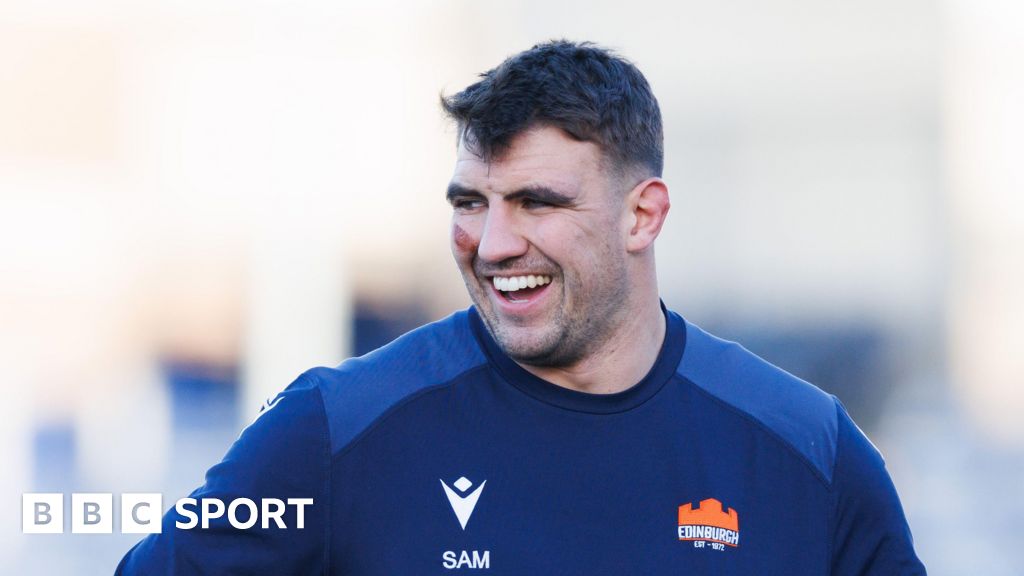 Edinburgh: Sam Skinner says club 'typically Scottish' - BBC Sport