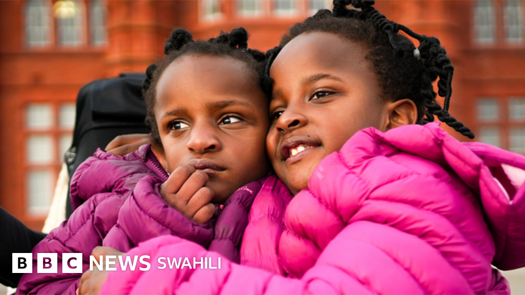 Pacha walioungana na kutarajiwa kuishi siku chache waimarika kinyume na ...