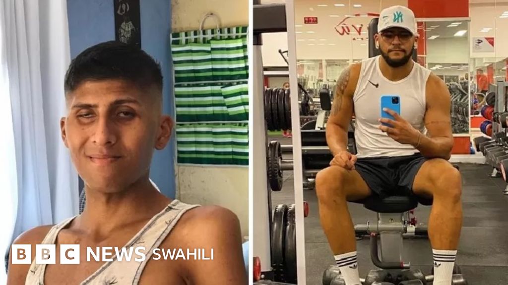 'Ukimwi ulinipokonya uwezo wa kuona wa jicho langu la kulia na kunizuia ...