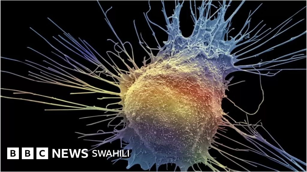 Saratani ya tezi dume: Ni kwanini wanaume wanafaa kuwa na wasiwasi ...