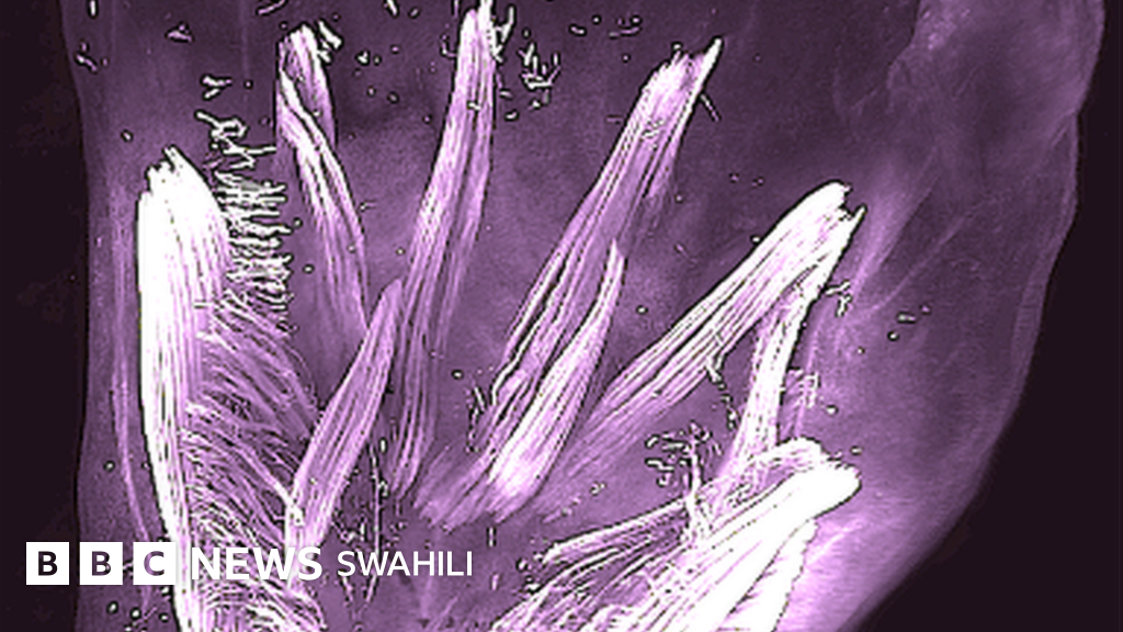 Watoto huwa na vidole kama mijusi tumboni ambayo huondoka kabla ...