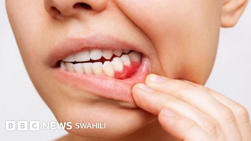 Jinsi afya ya kinywa chako inavyoweza kuwa kiashirio cha kinachotokea ...