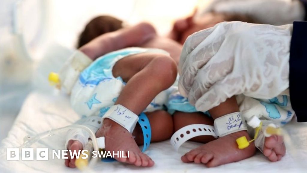 Yemen: Mapacha waliozaliwa wakiwa wameunganika wako 'katika hali hatari ...