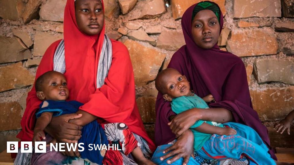 Watoto wanaokabiliwa na utapia mlo waongezeka Somalia - BBC News Swahili