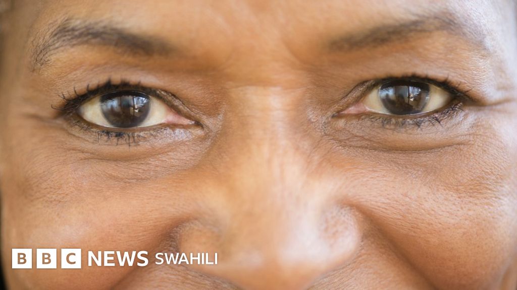 Jinsi macho yanavyoweza kuelezea hali yako ya afya - BBC News Swahili