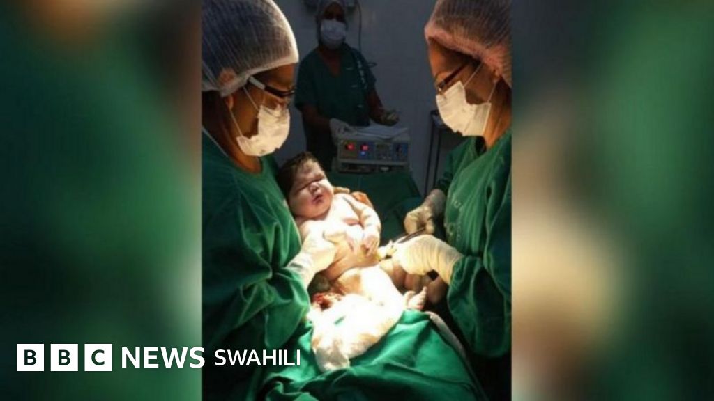 Kuna hatari gani kwa mtoto kuzaliwa na uzito mkubwa? - BBC News Swahili