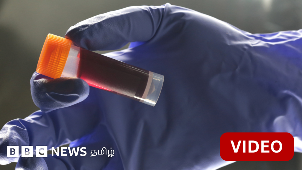 பெங்களூரு பெண்ணுக்கு உலகில் ஒருவருக்கும் இல்லாத புதிய வகை ரத்தம் கண்டுபிடிப்பு - BBC News தமிழ்