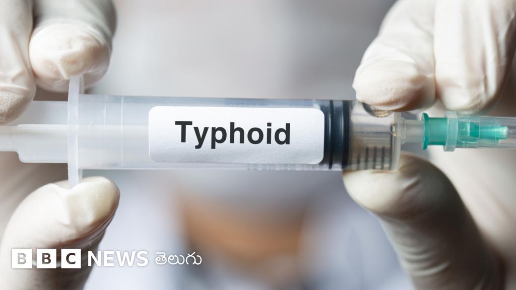 టైఫాయిడ్: వర్షాకాలంలో విజృంభించే ఈ వ్యాధి బారిన పడకుండా ఎలాంటి ...
