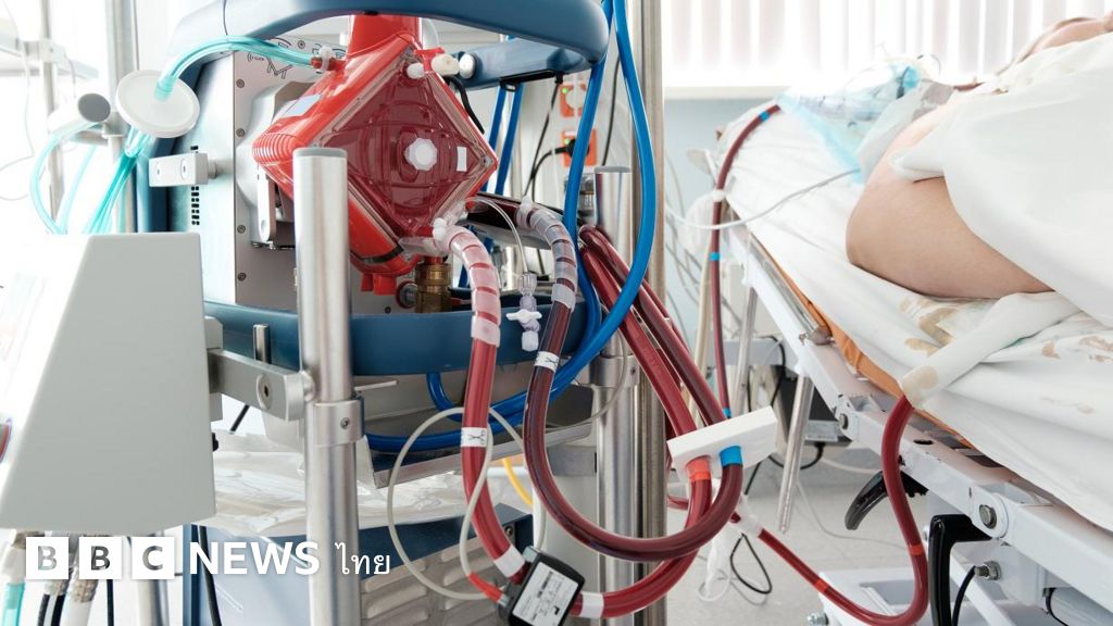 ECMO คืออะไร ทำงานอย่างไร ในผู้ป่วยหัวใจผิดปกติ - BBC News ไทย