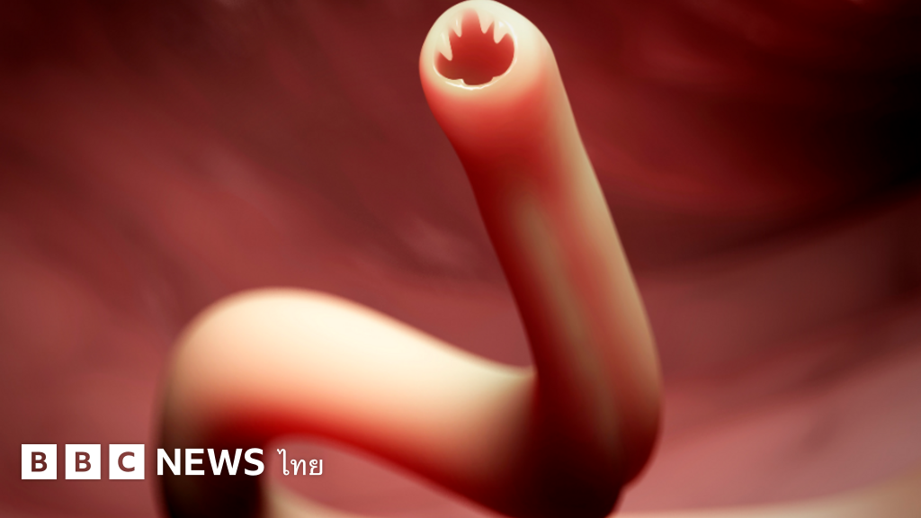 ลำไส้มีพยาธิปากขอไม่ต้องตกใจ ช่วยป้องกันโรคเบาหวานประเภทที่ 2 - BBC News ไทย