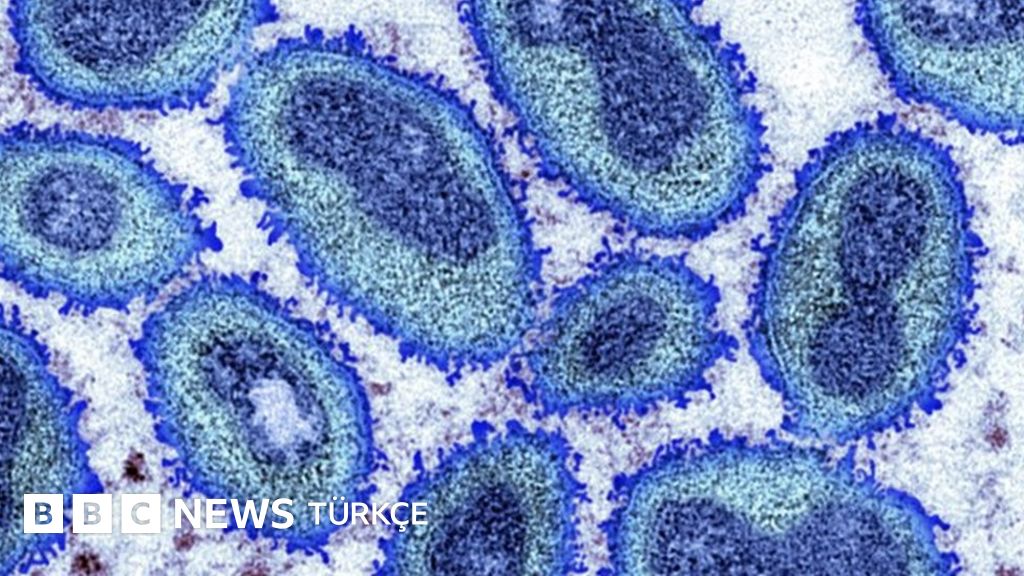 Maymun çiçeği virüsü: Afrika dışındaki vaka sayısı üçe katlanarak 780’e ...
