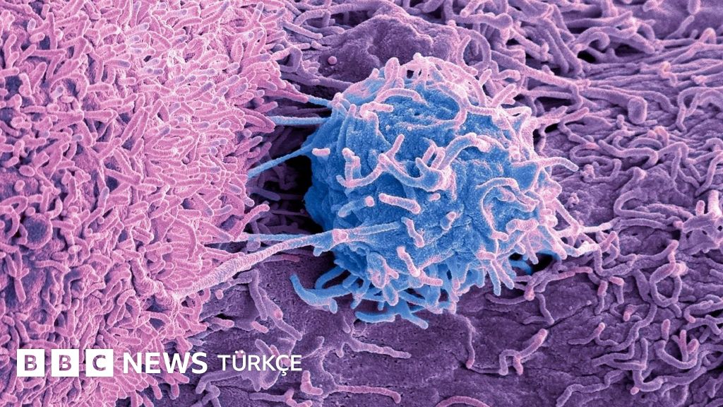 Tümörlerde yaşayan mikroplar, kanserin nedeni ve tedavisiyle ilgili ...