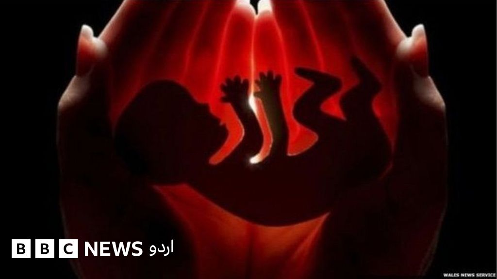 مردہ عورت کی بچہ دانی سے پہلی بار بچے کی پیدائش Bbc News اردو