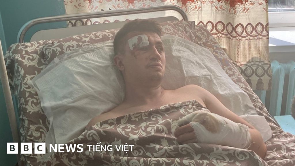 Cuộc chiến Ukraine: 'Tôi không nghĩ là Nga tấn công vào trung tâm mua ...