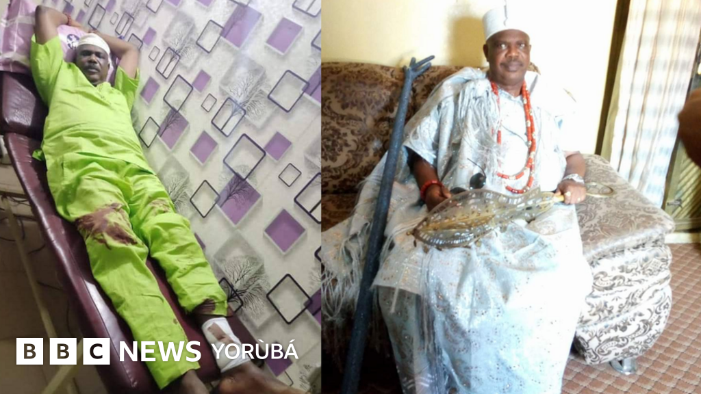 Ọba Atah ti Ayede Ekiti, Ọba Adeleye Orisagbemi dèrò ilé ìwòsàn l'Ekiti ...