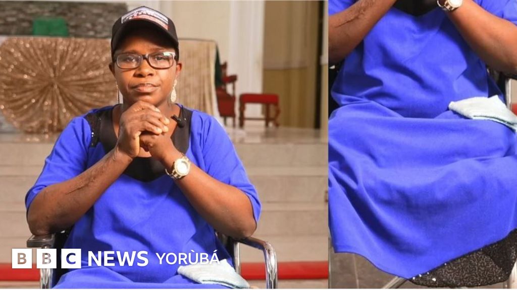 ‘Nígbà tí màá fi sọjí lẹ́yìn ariwo tí mo gbọ́, ojú mi ti kún fún ẹ̀jẹ̀ ...