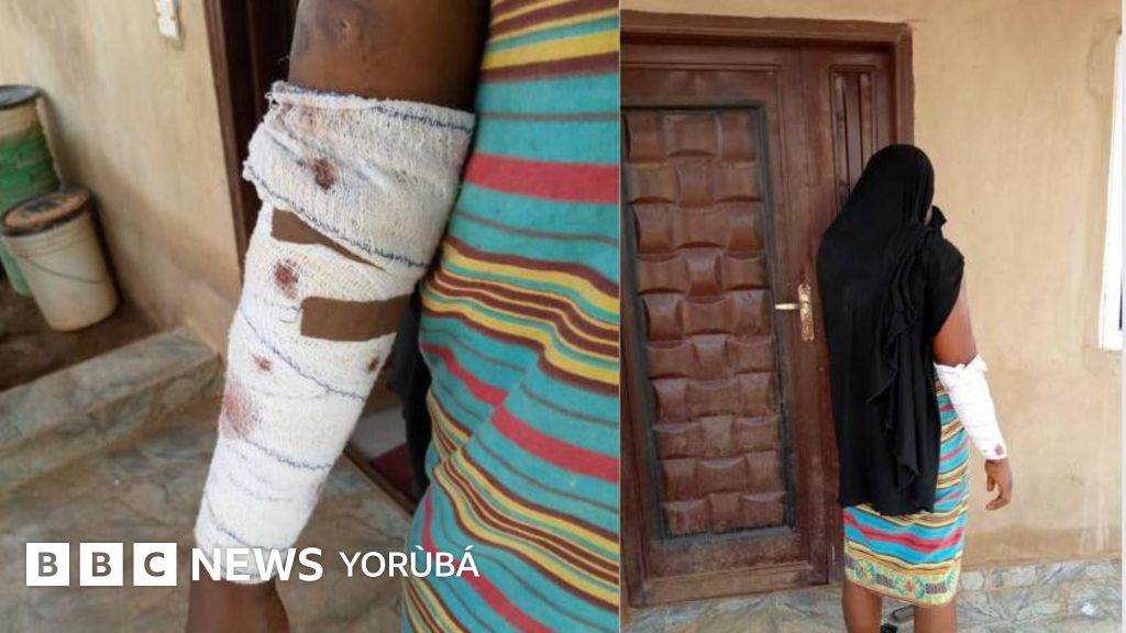 Dog kills baby in Osun: Nafisat ní ọmọ oṣù márùn-ún tí òun lo Hijab fún ...